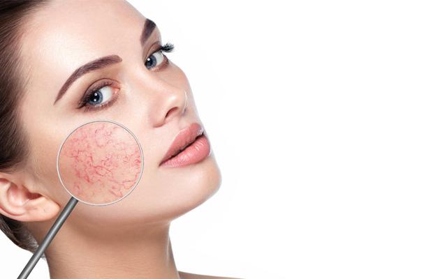 What is skin sensitivity? – Myers Dermatology & Clinical Spa
