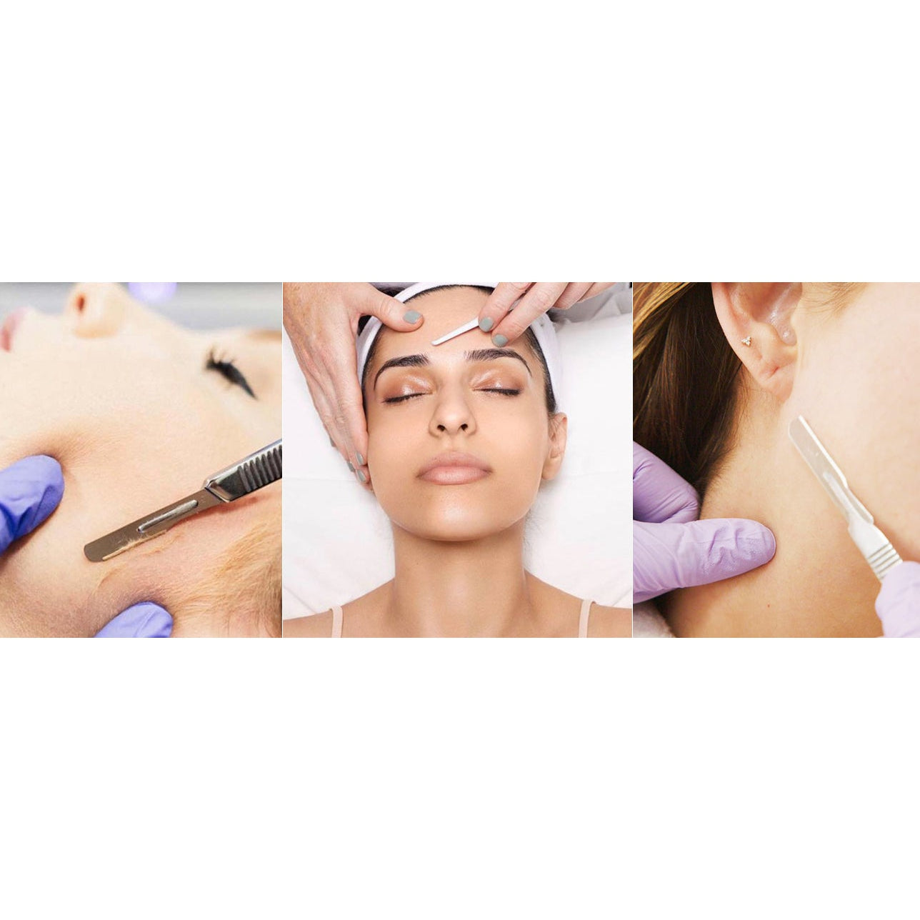 Dermaplane Treatment – Myers Dermatology & Clinical Spa